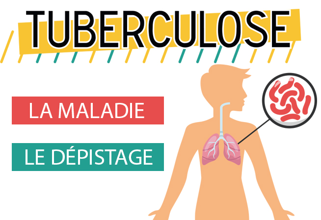 Qu'est-ce-que la tuberculose ? | Agence régionale de santé Nouvelle ...