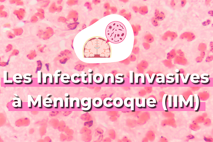 Les Infections Invasives à Méningocoque (méningite, septicémie) : se ...